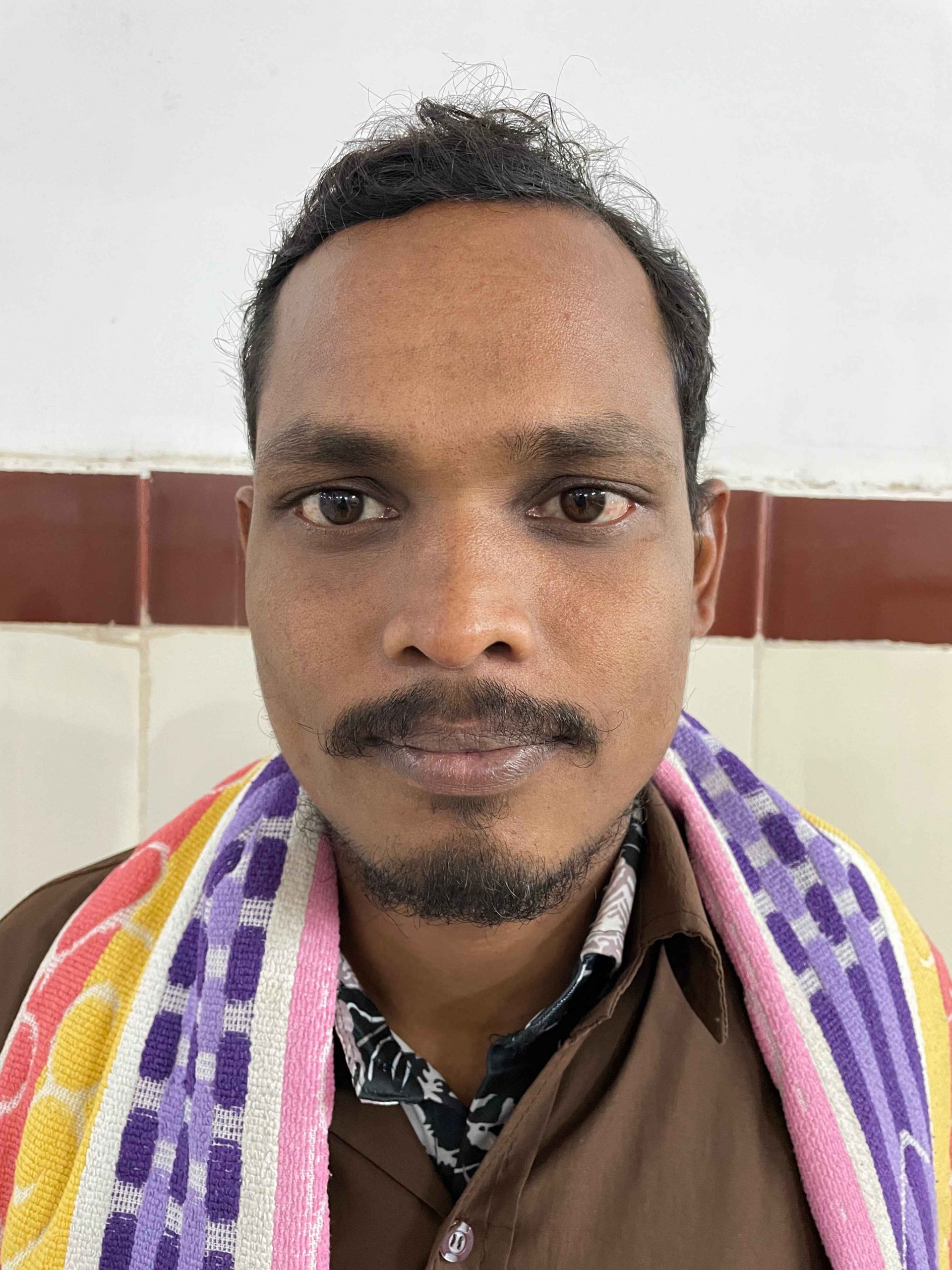 Oral & Maxillofacial Surgery – SCB Dental College and Hospital ...